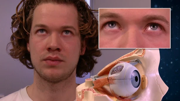 Wat is scheelzien? | Schooltv